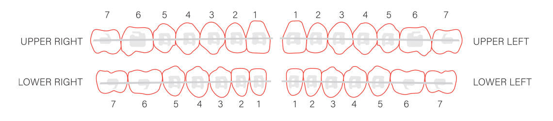 How to and why wear your elastic orthodontic bands | Elastic ...